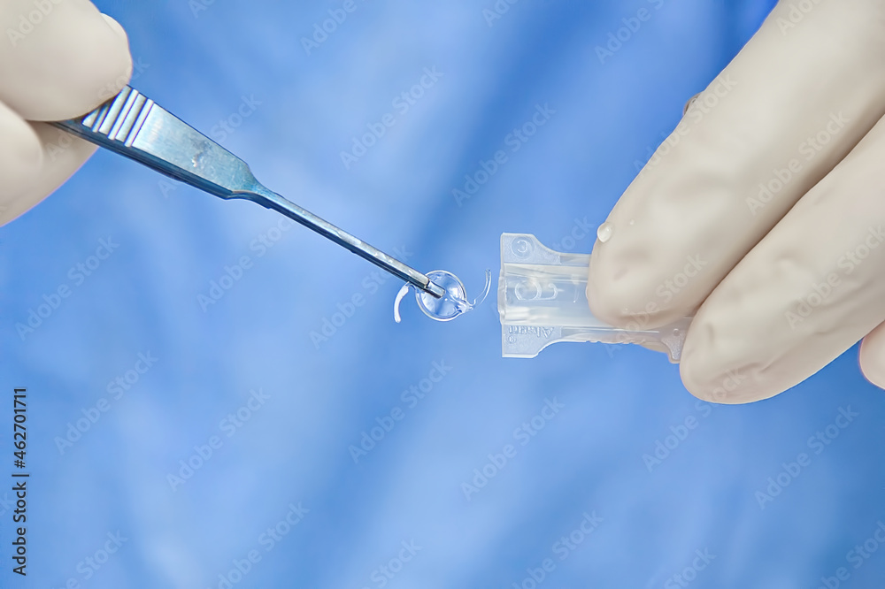 iol intraocular lens cataract ophthalmology Stock Photo | Adobe Stock