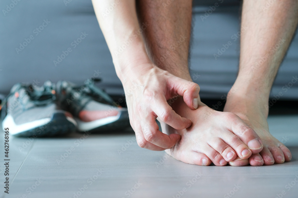 Men wear canvas shoes, he scratches legs and feet with itchy skin ...