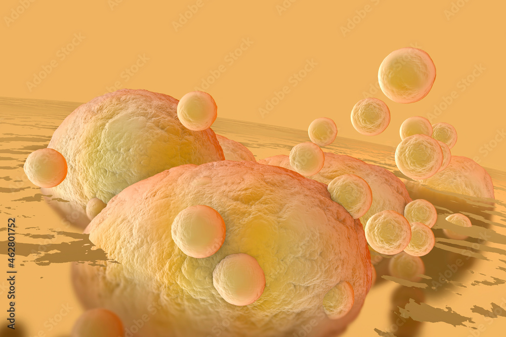 3D Rendered Illustration, visualization of Fat Cells clogging together ...