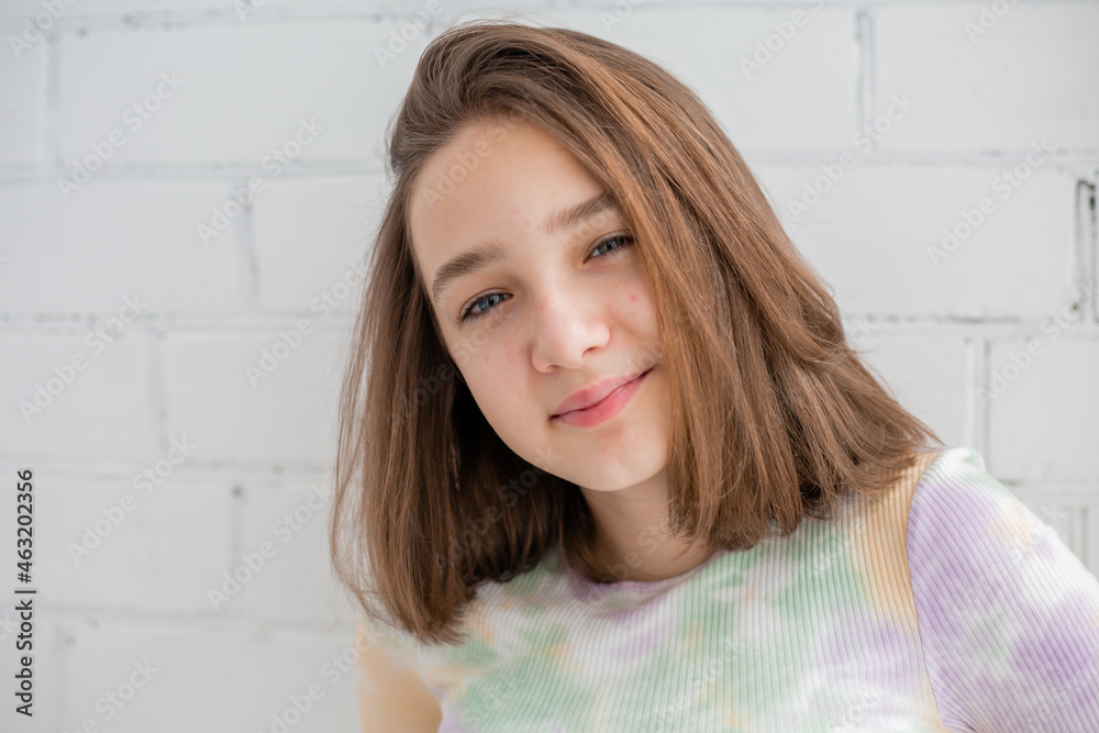 Face of a teenage girl in close up. Teen with problematic skin. Girl ...