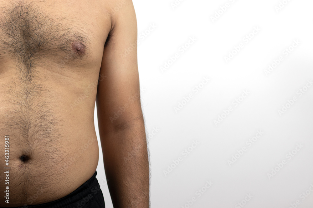 A front-side photo of a shirtless man with a rather fat, bulging body ...