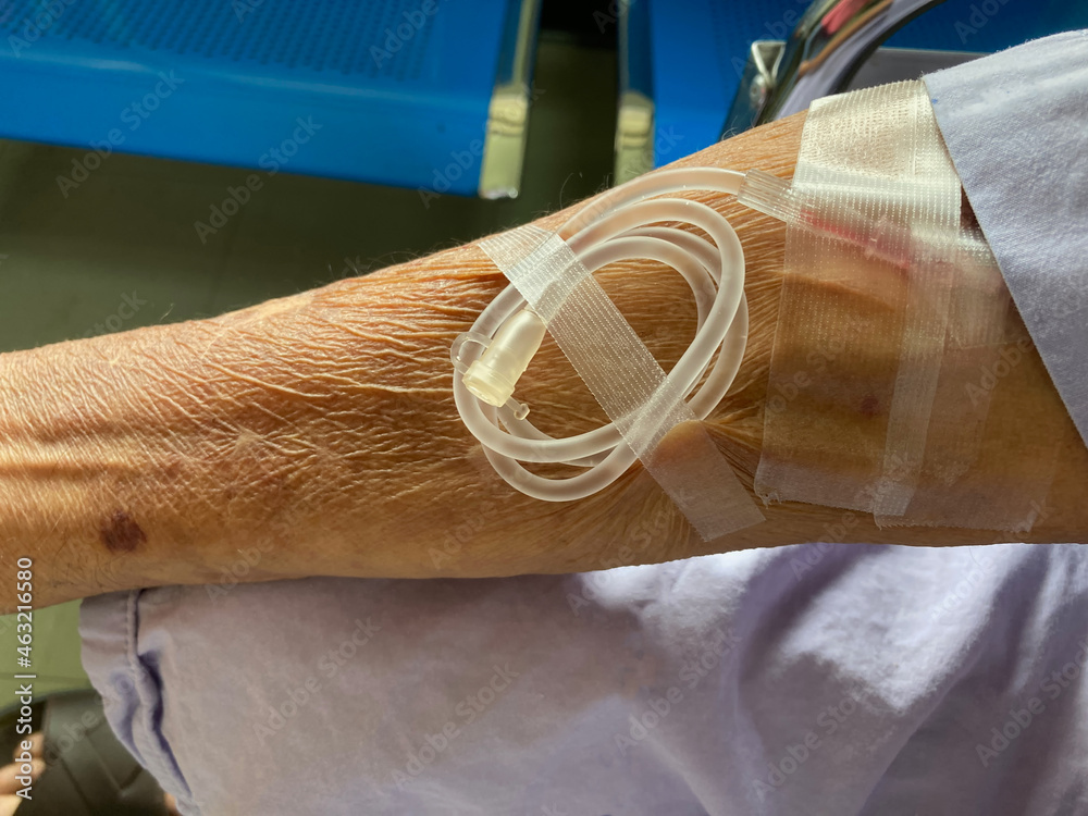 Extension Tube for peripheral venous cannulation on the arm of an ...