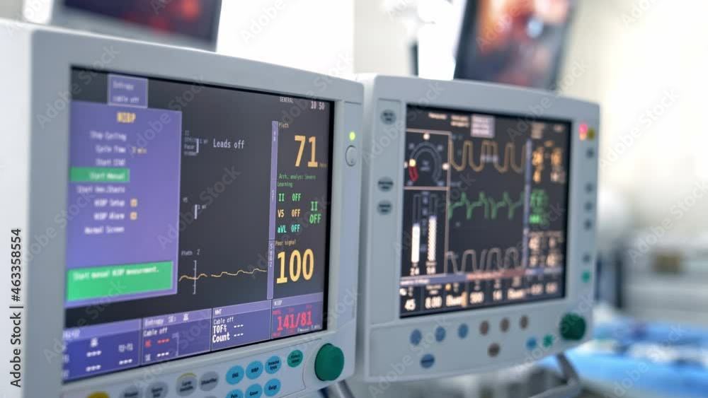 Monitors in hospital theater. Medical vital signs monitors in a ...