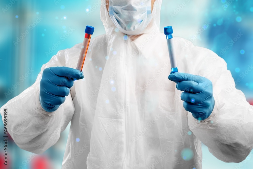 Hand holding blood sample tube. Blood sample for coagulation test in ...