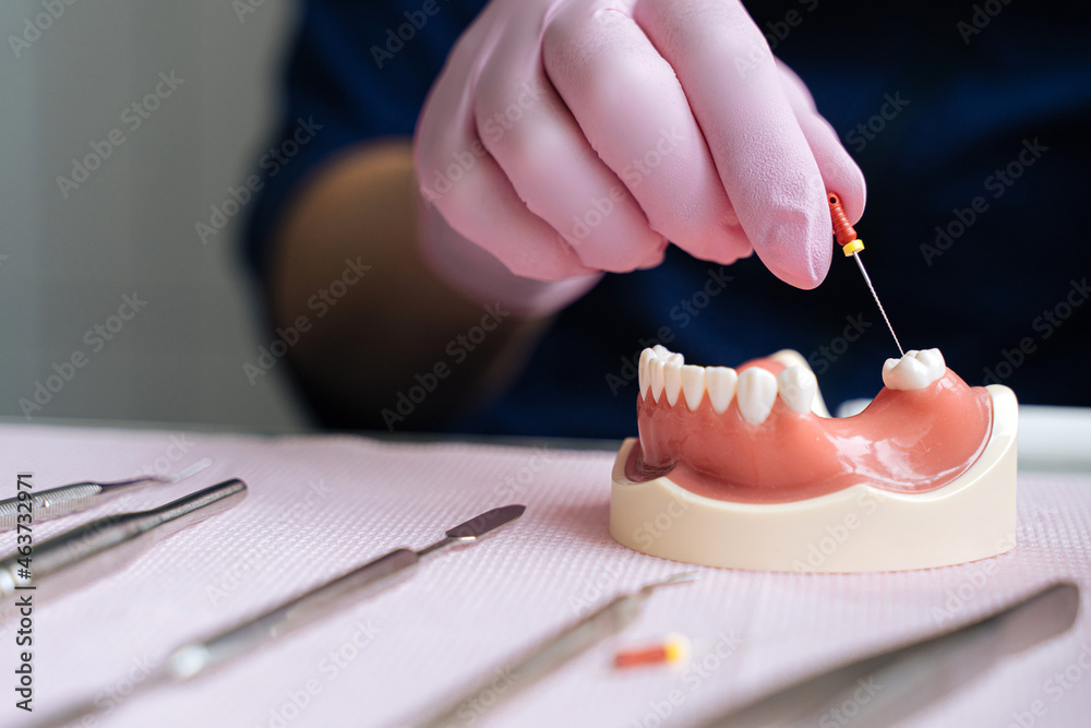 Dentist learning root canal treatment Stock Photo | Adobe Stock