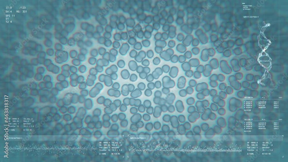 Cells in liqiuid under microscope. Research, genetic engineering ...