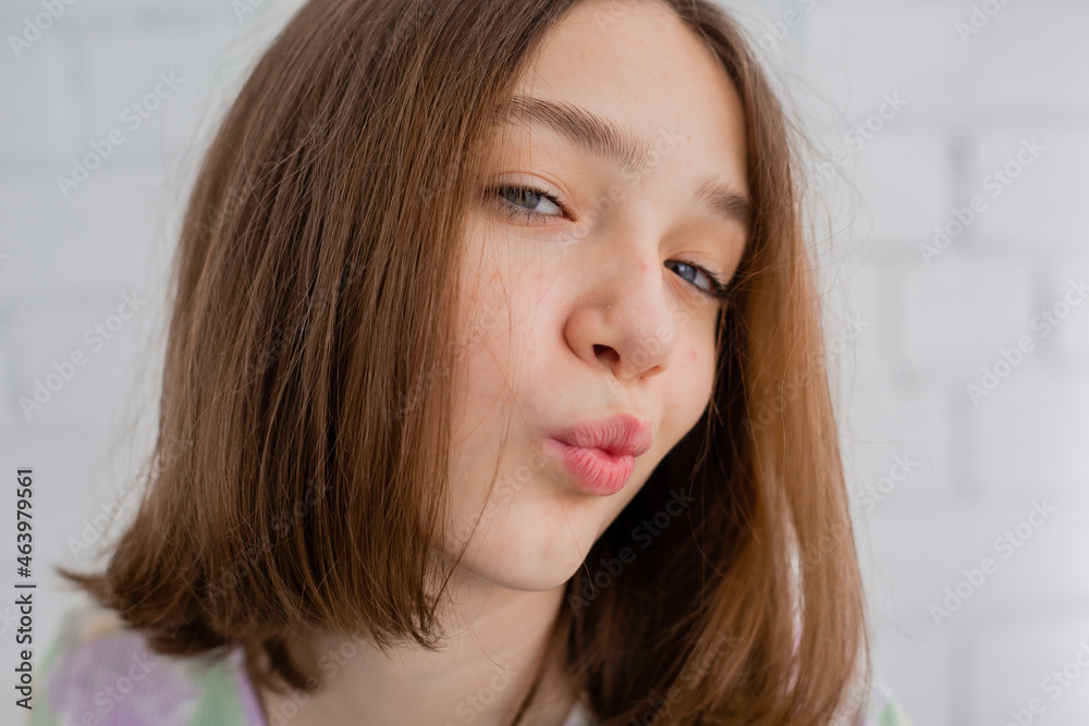 Face of a teenage girl in close up. Teen with problematic skin. Girl ...