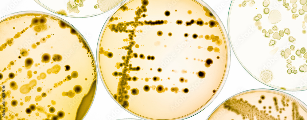 Bacterial colonies on agar plates Stock Photo | Adobe Stock
