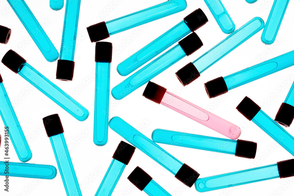 Test tubes Stock Photo | Adobe Stock