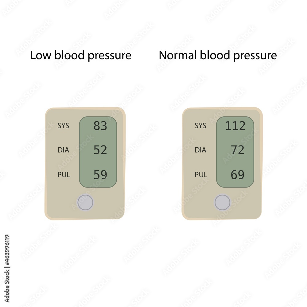 Normal and low blood pressure, illustration Stock Illustration | Adobe ...