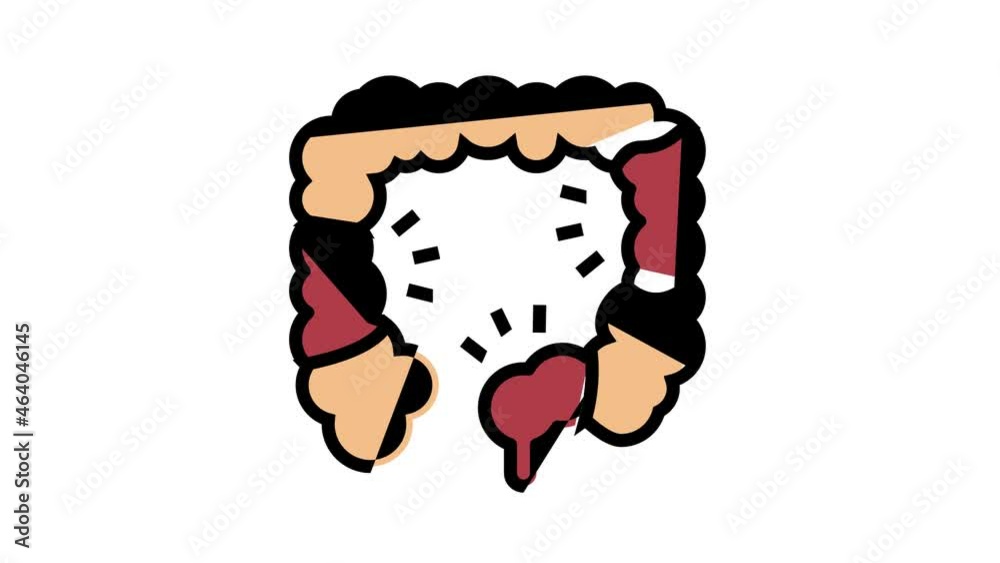 colitis disease animated color icon. colitis disease sign. isolated on ...