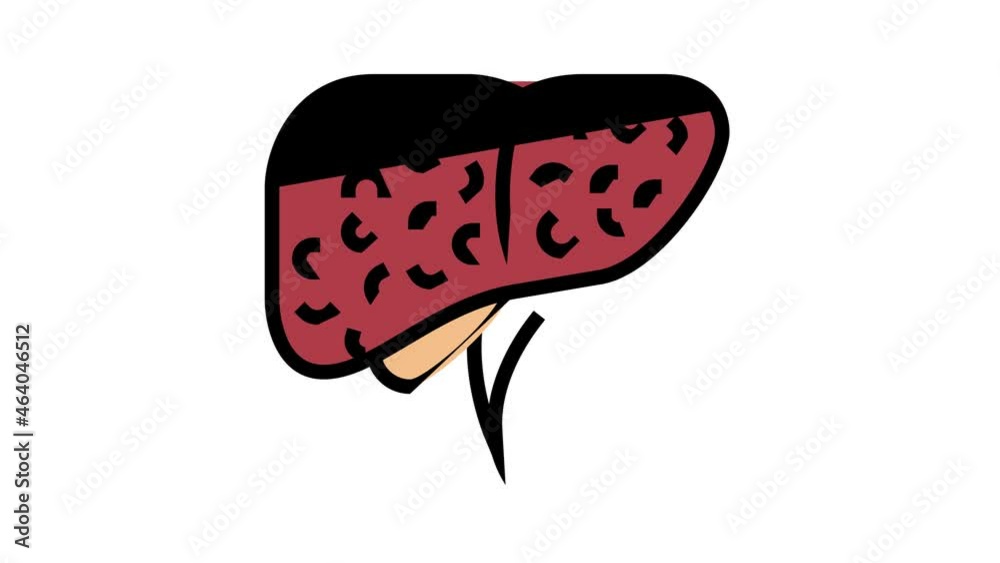 liver cirrhosis disease animated color icon. liver cirrhosis disease ...