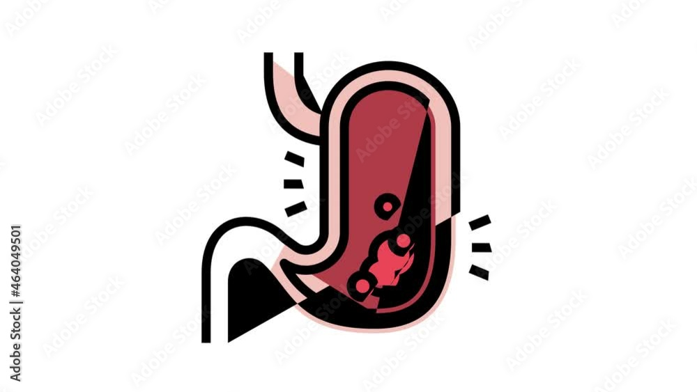 gastric disease animated color icon. gastric disease sign. isolated on ...
