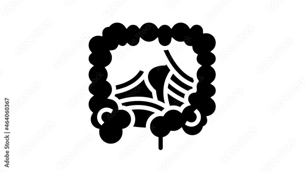 intestinal obstruction disease animated glyph icon. intestinal ...