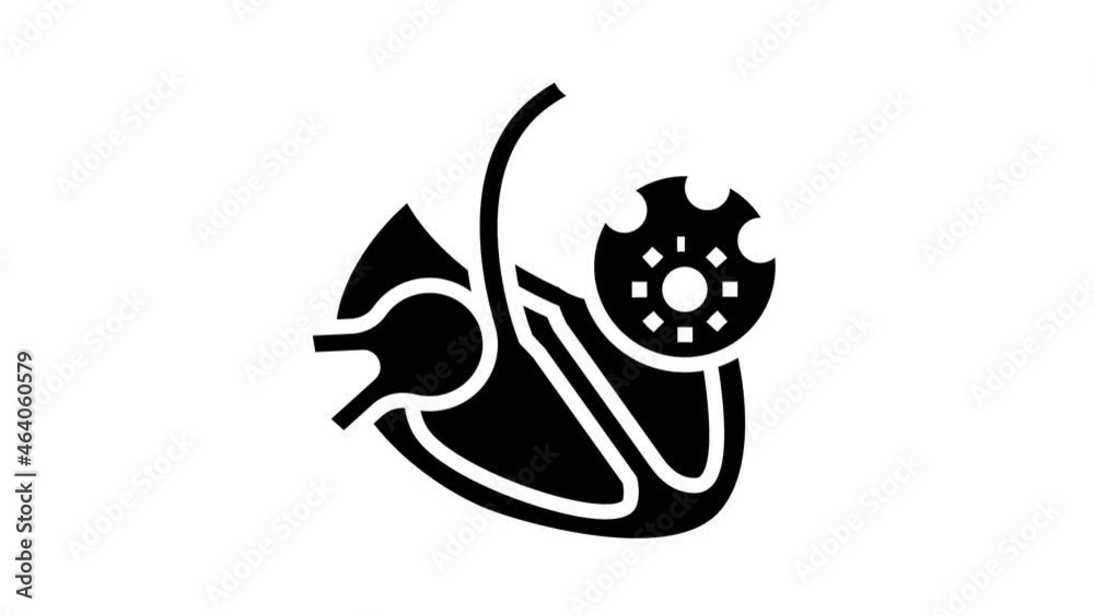 myocarditis disease animated glyph icon. myocarditis disease sign ...