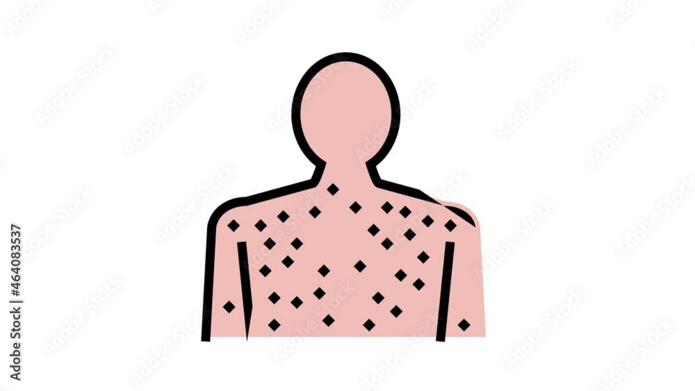 skin rash disease animated color icon. skin rash disease sign. isolated ...