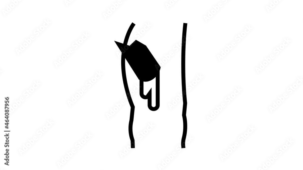 Open Limb Fracture Disease Animated Line Icon Open Limb Fracture