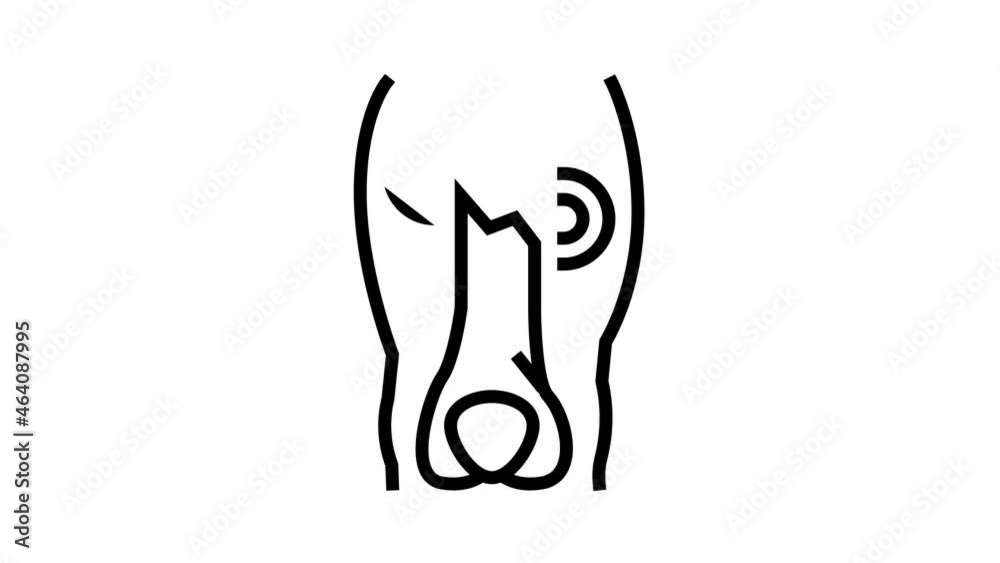 Closed Limb Fracture Disease Animated Line Icon Closed Limb Fracture