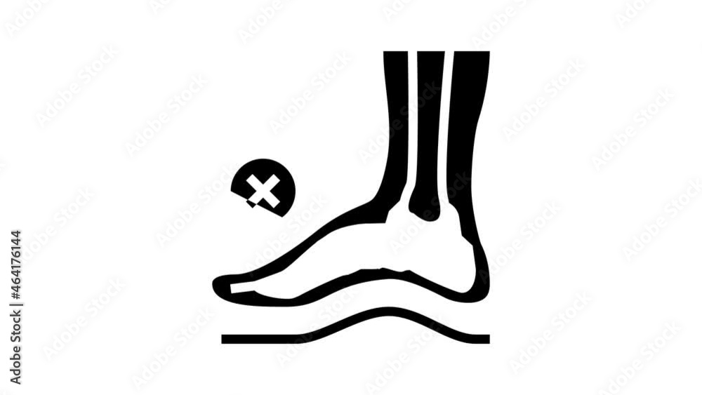 bone postural deformity feet animated glyph icon. bone postural ...