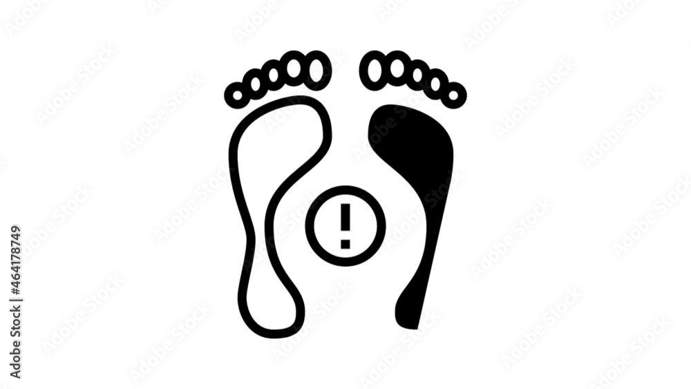 postural deformity feet animated line icon. postural deformity feet ...