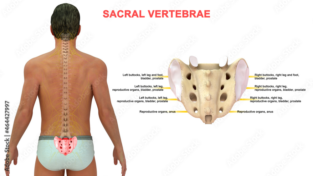 The sacrum, sometimes called the sacral vertebra or sacral spine (S1 ...