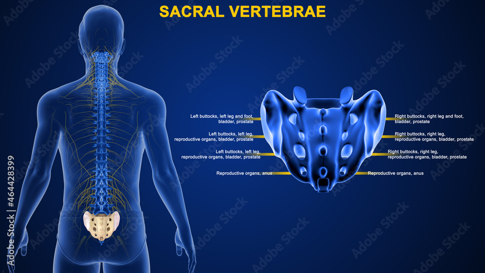 The sacrum, sometimes called the sacral vertebra or sacral spine (S1 ...