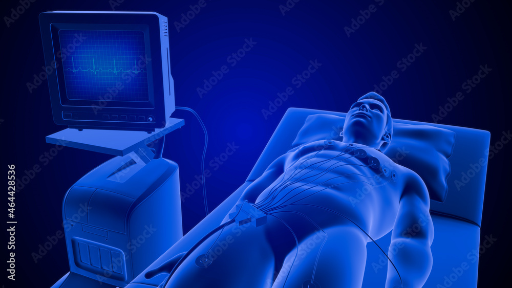 An electrocardiogram (ECG) is a simple test that can be used to check ...