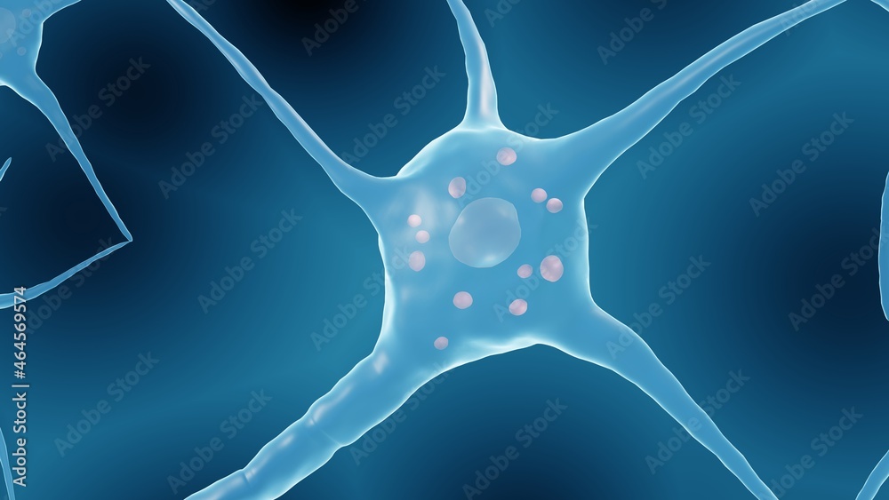 Lewy bodies in a neuron, Accumulations of proteins that develop inside ...