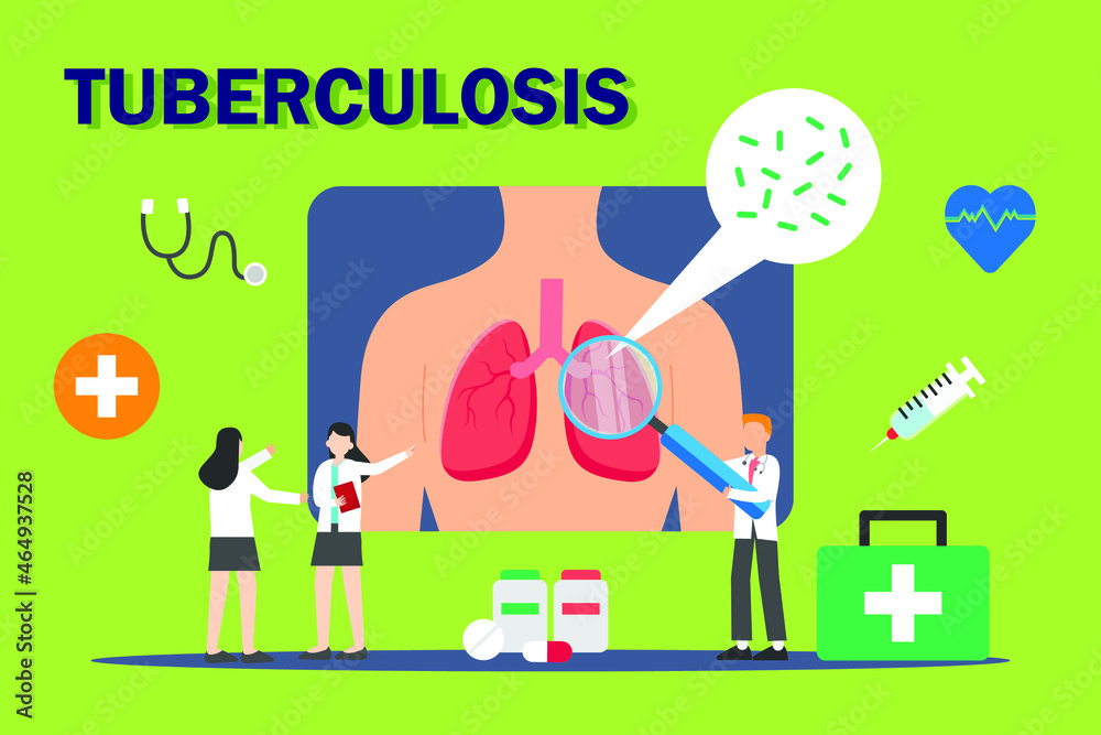 Tuberculosis disease vector concept. Group of doctor examining ...