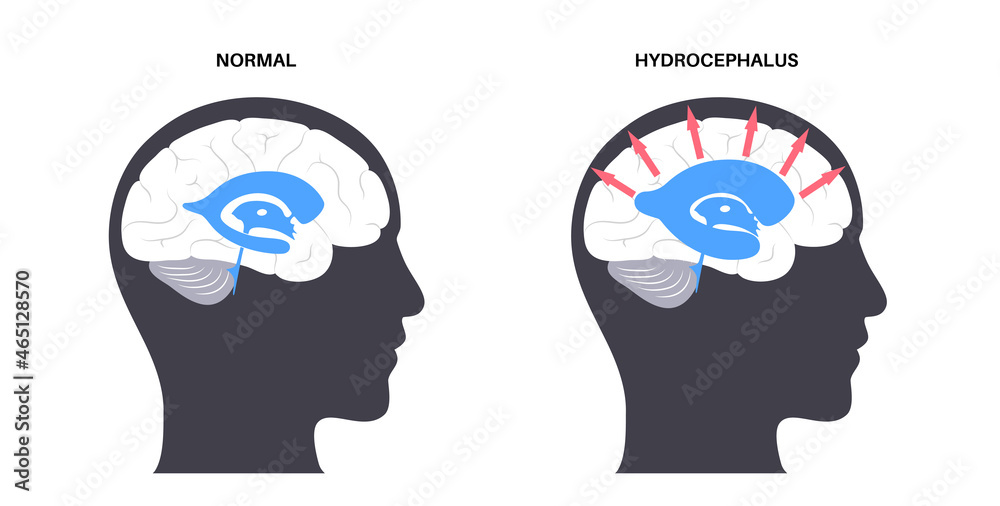 Poster Ventricular system concept – Wall Art | UkPosters
