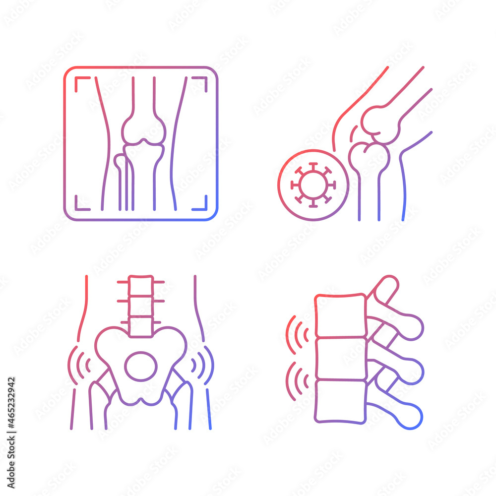 Extreme aching in bones gradient linear vector icons set. Arthritis x ...