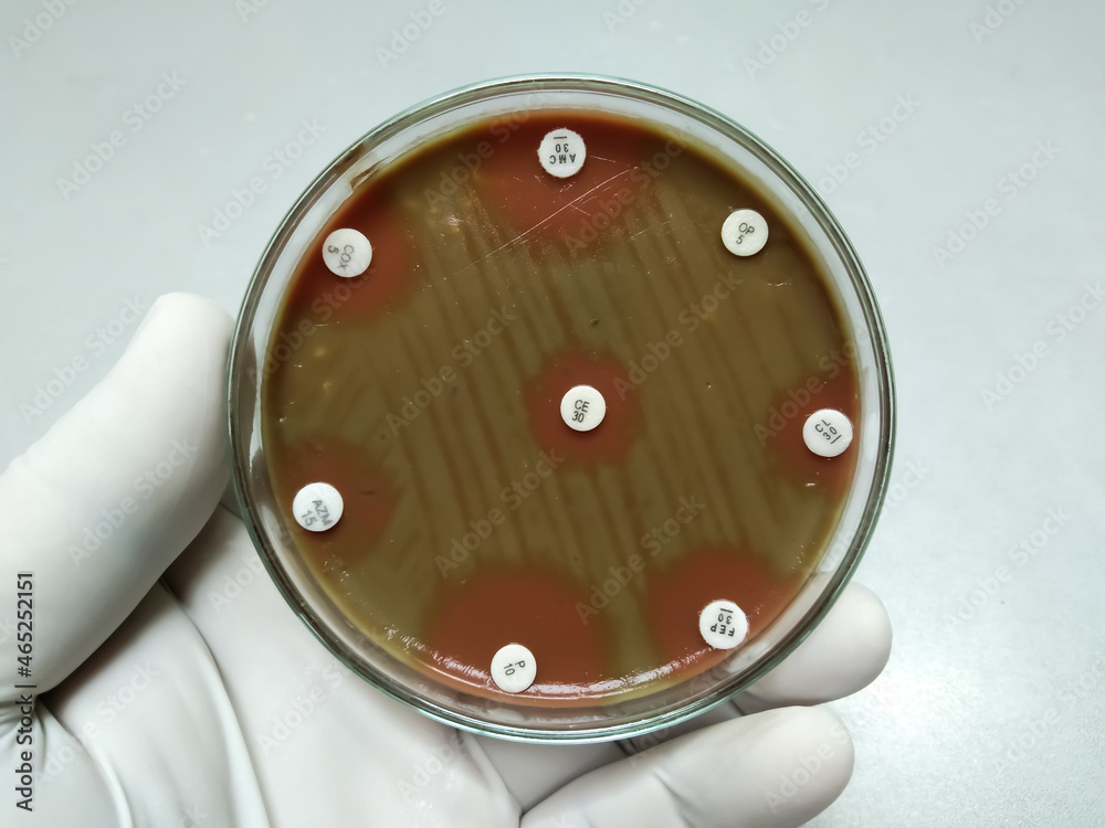 Antimicrobial susceptibility test against streptococcus pneumoniae ...