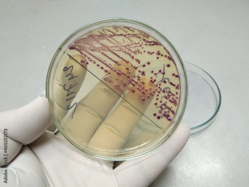 Foto de Bacteria colony of Escherichia coli (E.coli) in culture media ...