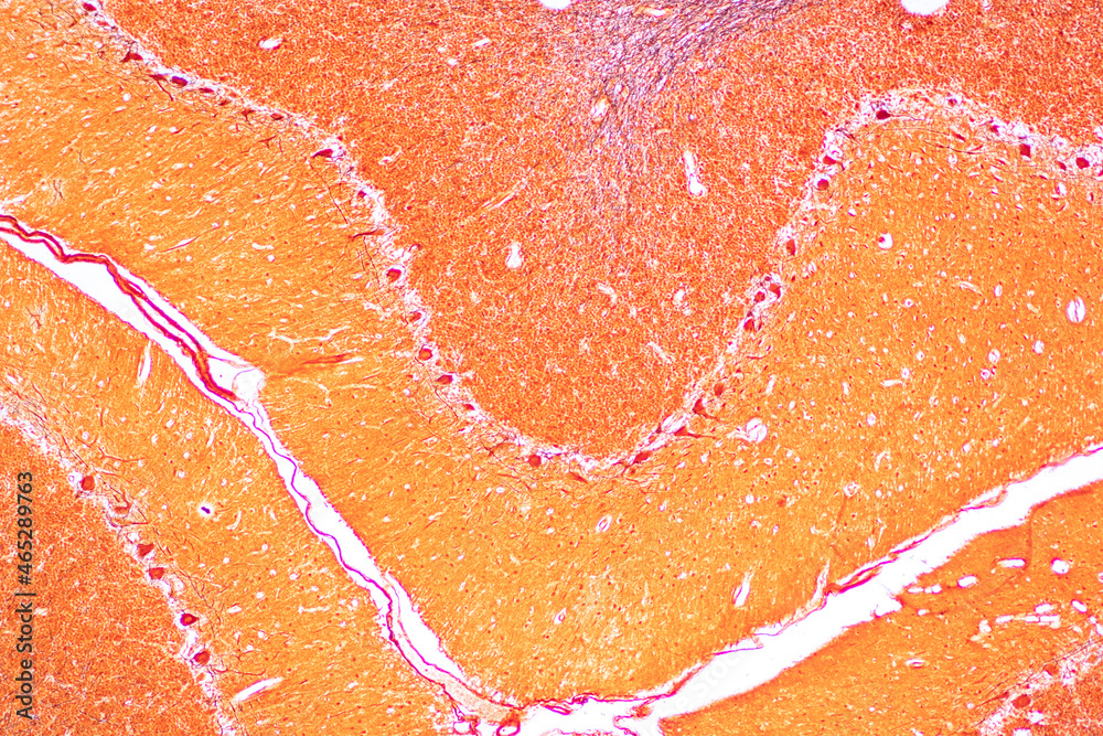 Cerebellum, Thalamus, Medulla oblongata, Spinal cord and Motor Neuron ...