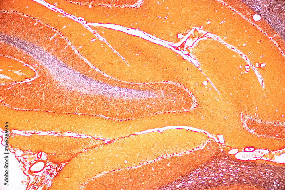 Cerebellum, Thalamus, Medulla oblongata, Spinal cord and Motor Neuron ...