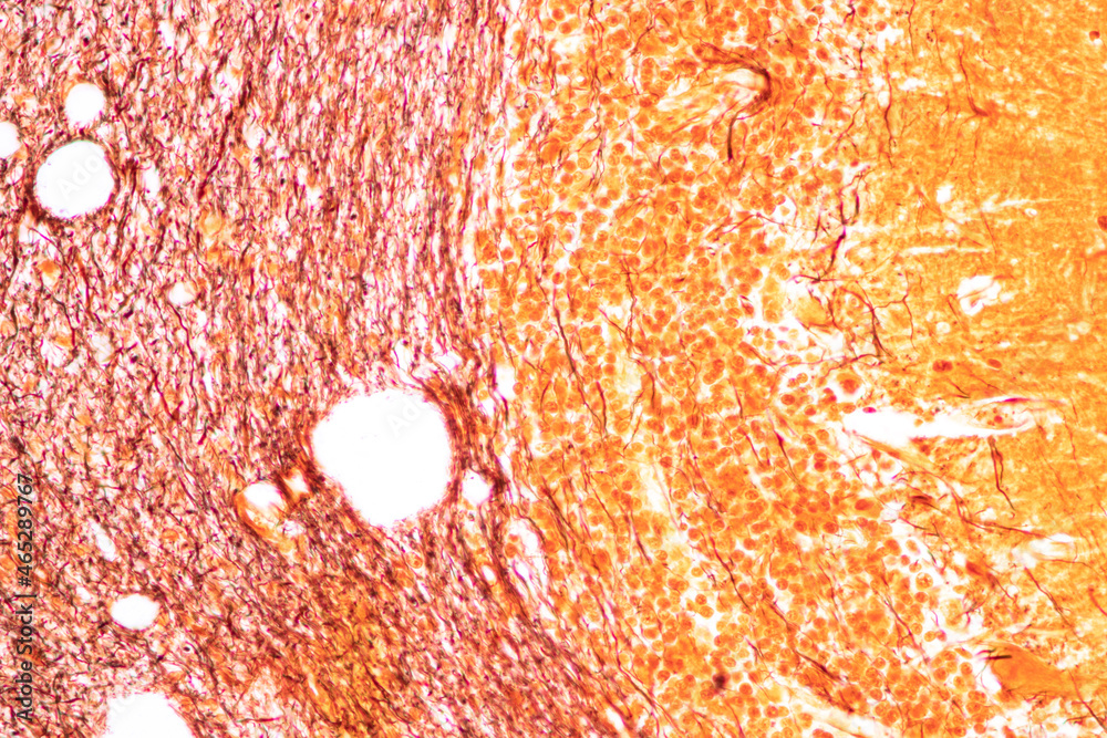 Cerebellum, Thalamus, Medulla oblongata, Spinal cord and Motor Neuron ...