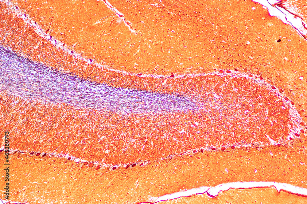 Cerebellum, Thalamus, Medulla oblongata, Spinal cord and Motor Neuron ...