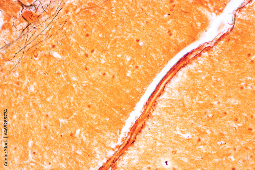 Cerebellum, Thalamus, Medulla oblongata, Spinal cord and Motor Neuron ...