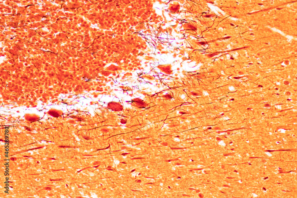 Cerebellum, Thalamus, Medulla oblongata, Spinal cord and Motor Neuron ...
