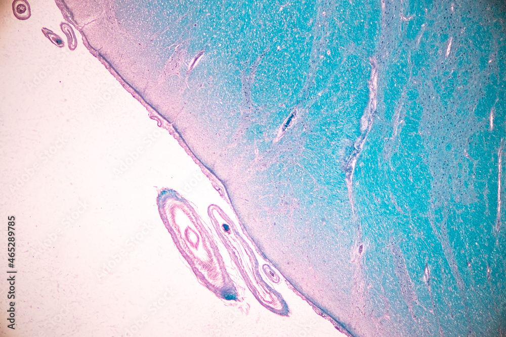 Cerebellum, Thalamus, Medulla oblongata, Spinal cord and Motor Neuron ...