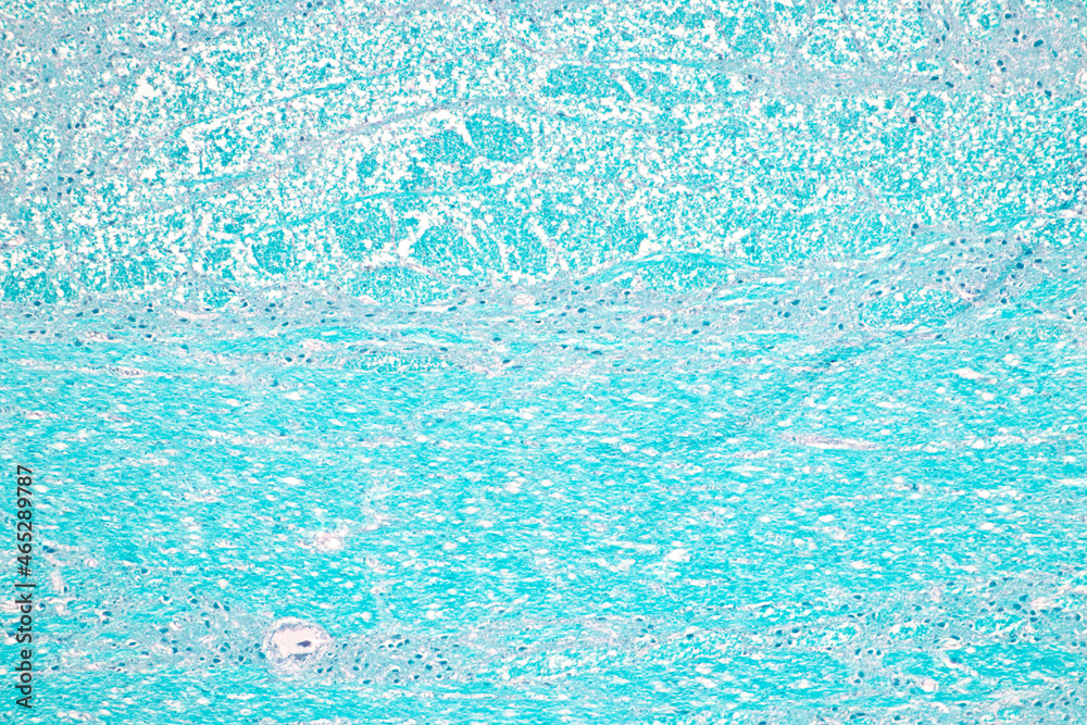 Cerebellum, Thalamus, Medulla oblongata, Spinal cord and Motor Neuron ...