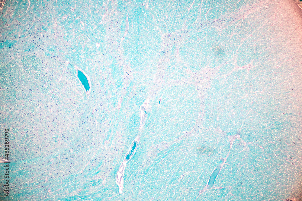 Poster Cerebellum, Thalamus, Medulla oblongata, Spinal cord and Motor ...
