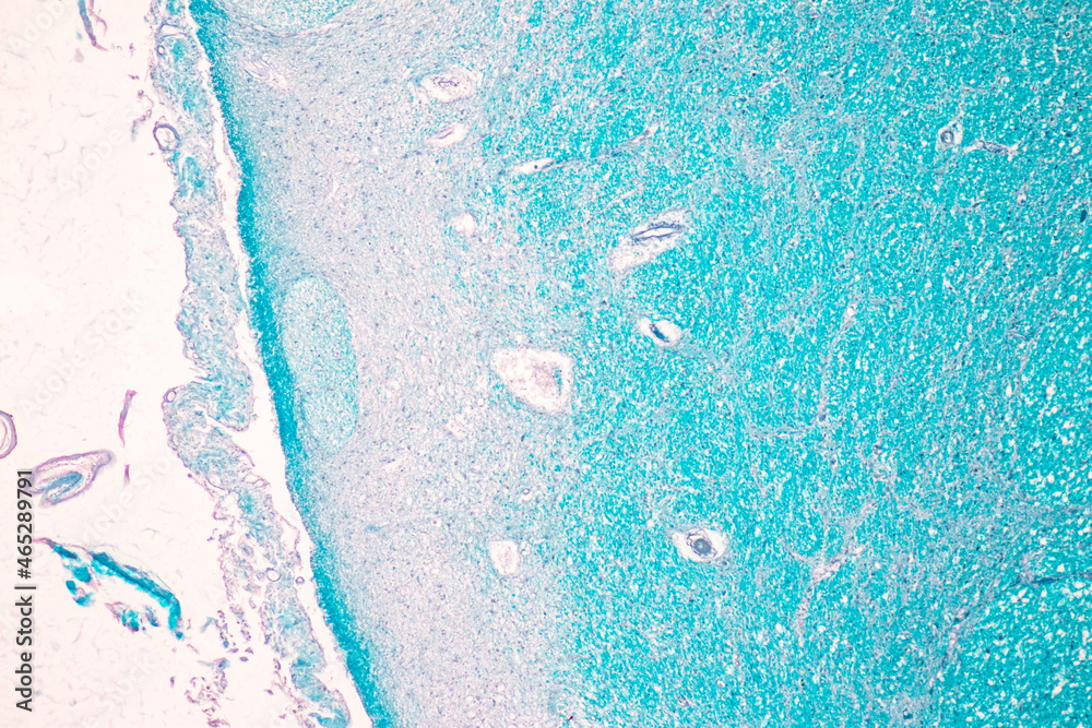 Cerebellum, Thalamus, Medulla oblongata, Spinal cord and Motor Neuron ...