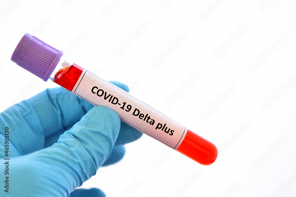 Delta plus COVID-19 positive, blood sample positive with delta plus ...