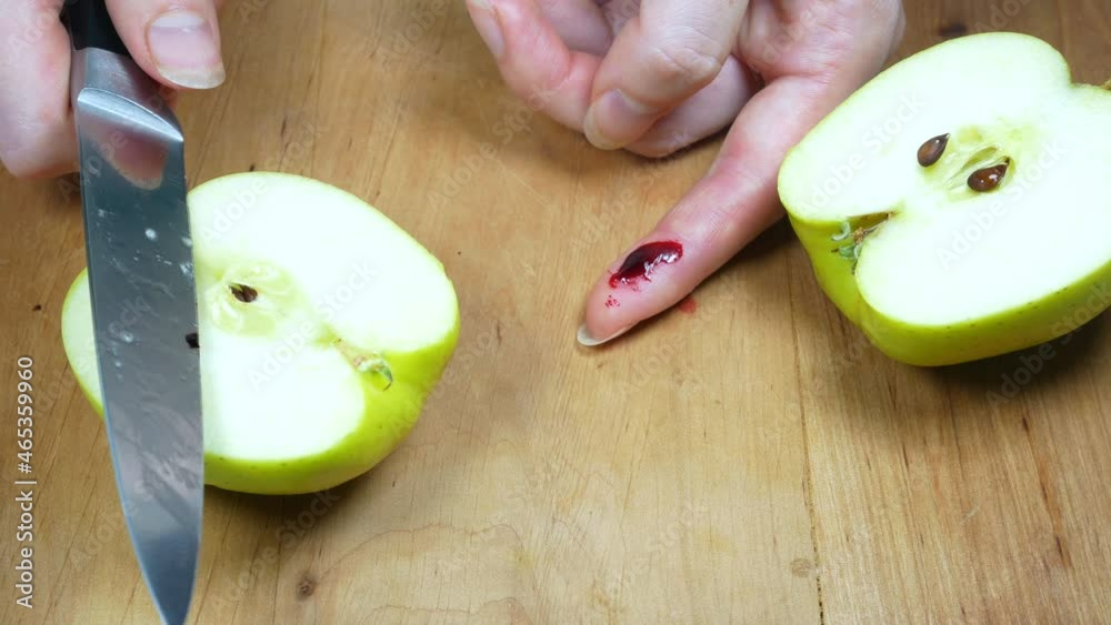 Woman cut her finger with a knife while cooking on the kitchen. Finger ...