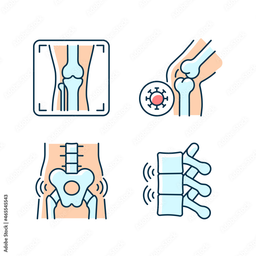 Extreme aching in bones RGB color icons set. Arthritis x ray ...