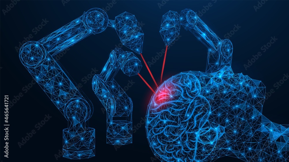 Laser surgery on the human brain. Robotic medical equipment. A low-poly ...