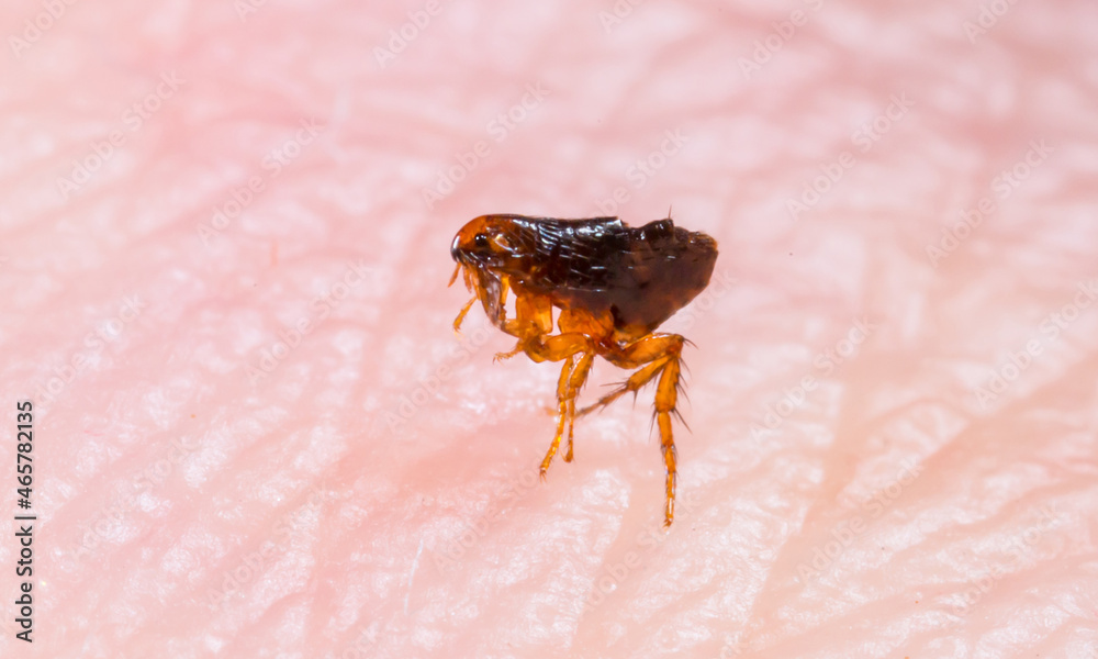 Flea on human skin close up. Extermination of parasites, insecticides ...