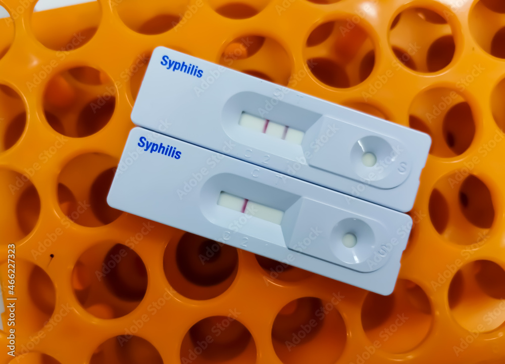 Top view of two rapid testing device of Syphilis, showing both positive ... Top view of two rapid testing device of Syphilis, showing both positive ...