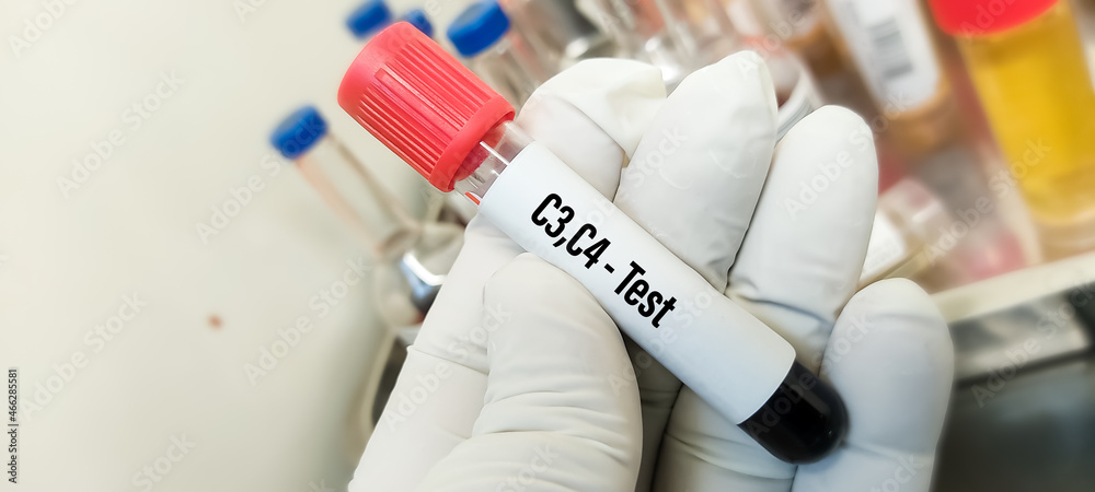 Blood Sample for C3, C4 (Complement) Test with laboratory background ...